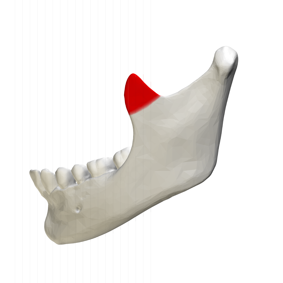 Temporal Tendinitis Rancho Santa Margarita | Jaw Pain Treatment ...