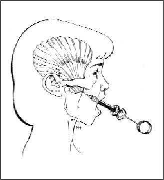 Temporal Tendinitis [Rancho Santa Margarita] [California], [Orange ...